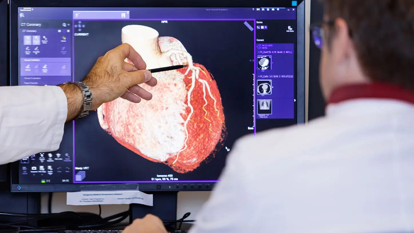 Cardiovascular research | RUHX | Official NHS Charity of RUH Bath